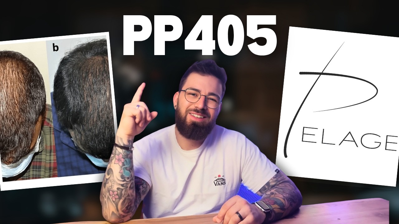Phase 2a Clinical Trial Results for PP405 - Hair Loss Cure - YouTube