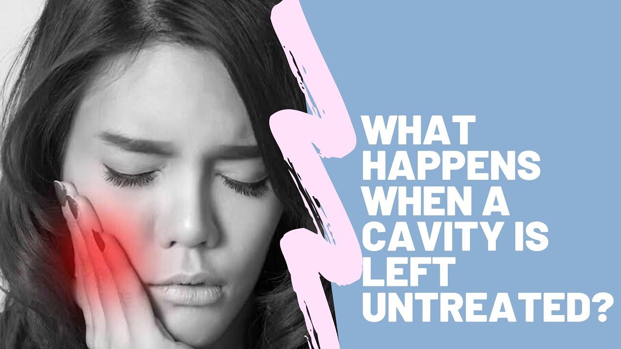 What happens when a cavity is left untreated? - YouTube