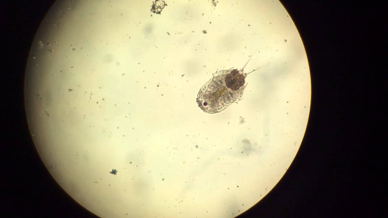 Nauplius - Crustacean larvae - YouTube