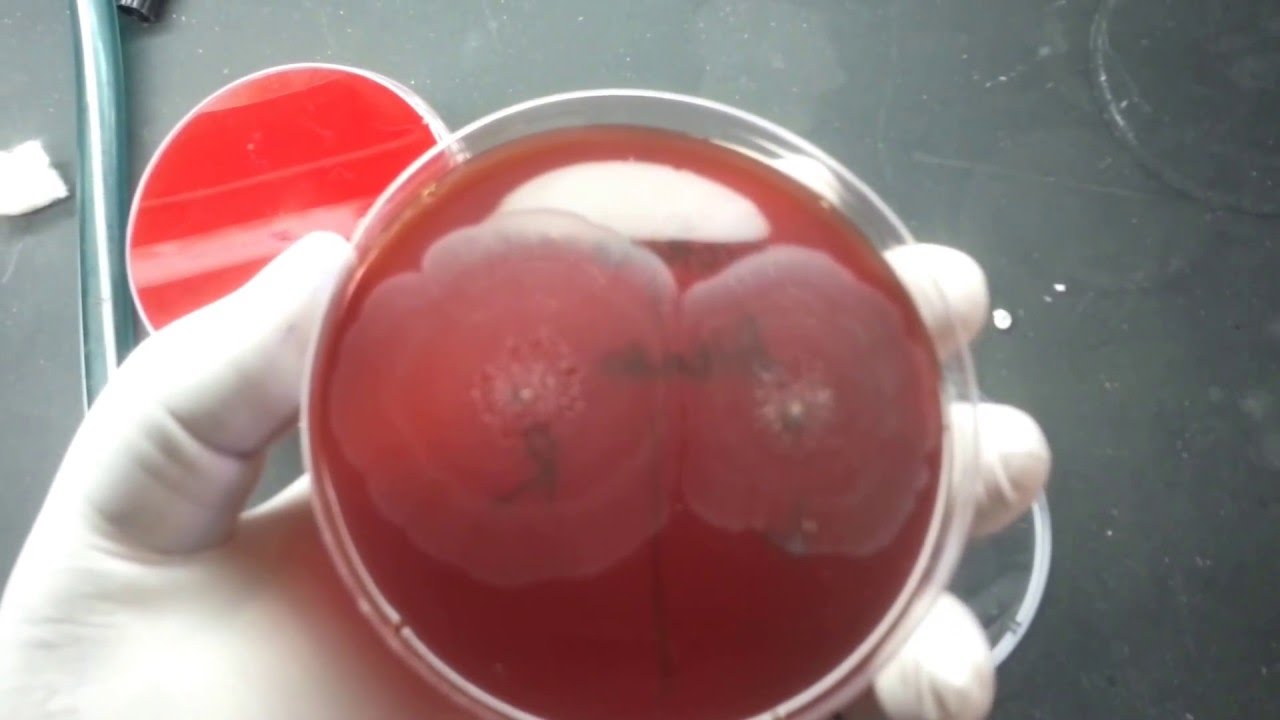 Dienes Phenomenon - YouTube