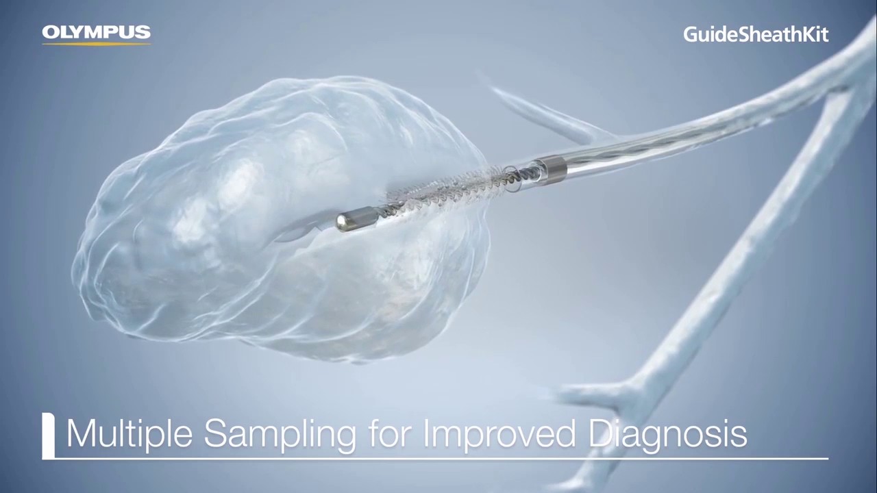 Olympus slim bronchoscope with radial EBUS miniprobe for peripheral ...