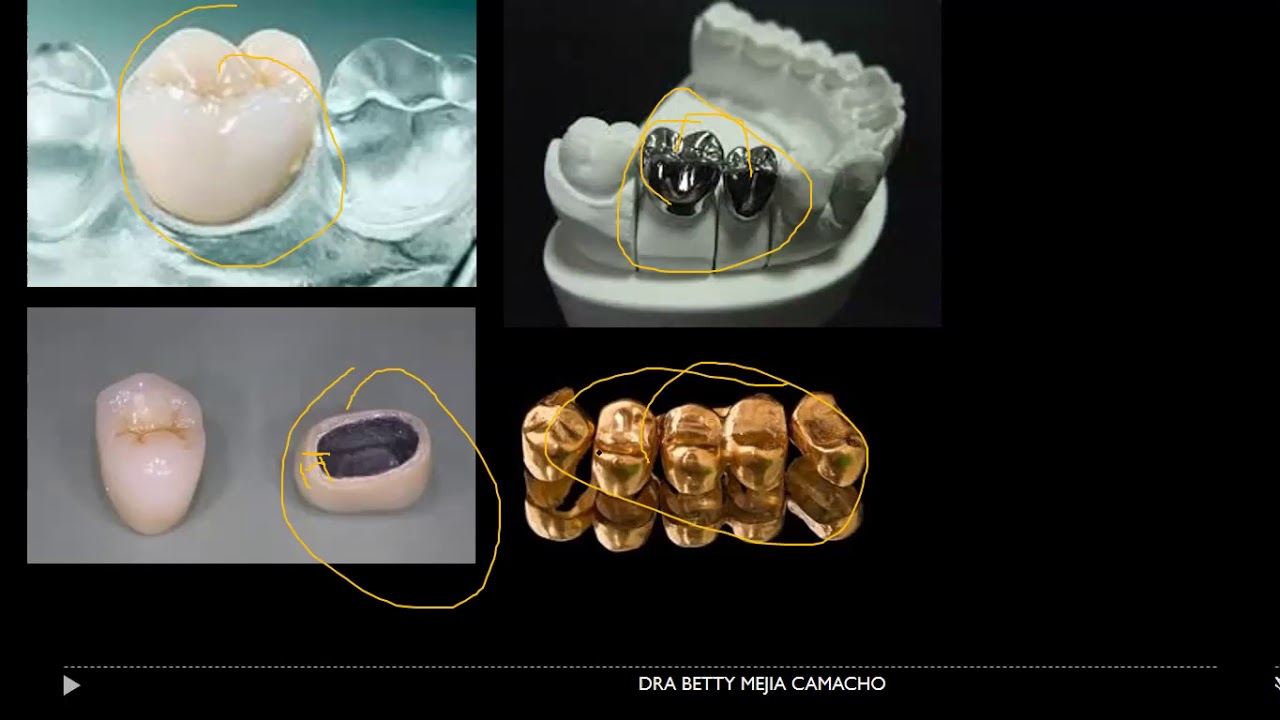 Marco De Corona De Metal