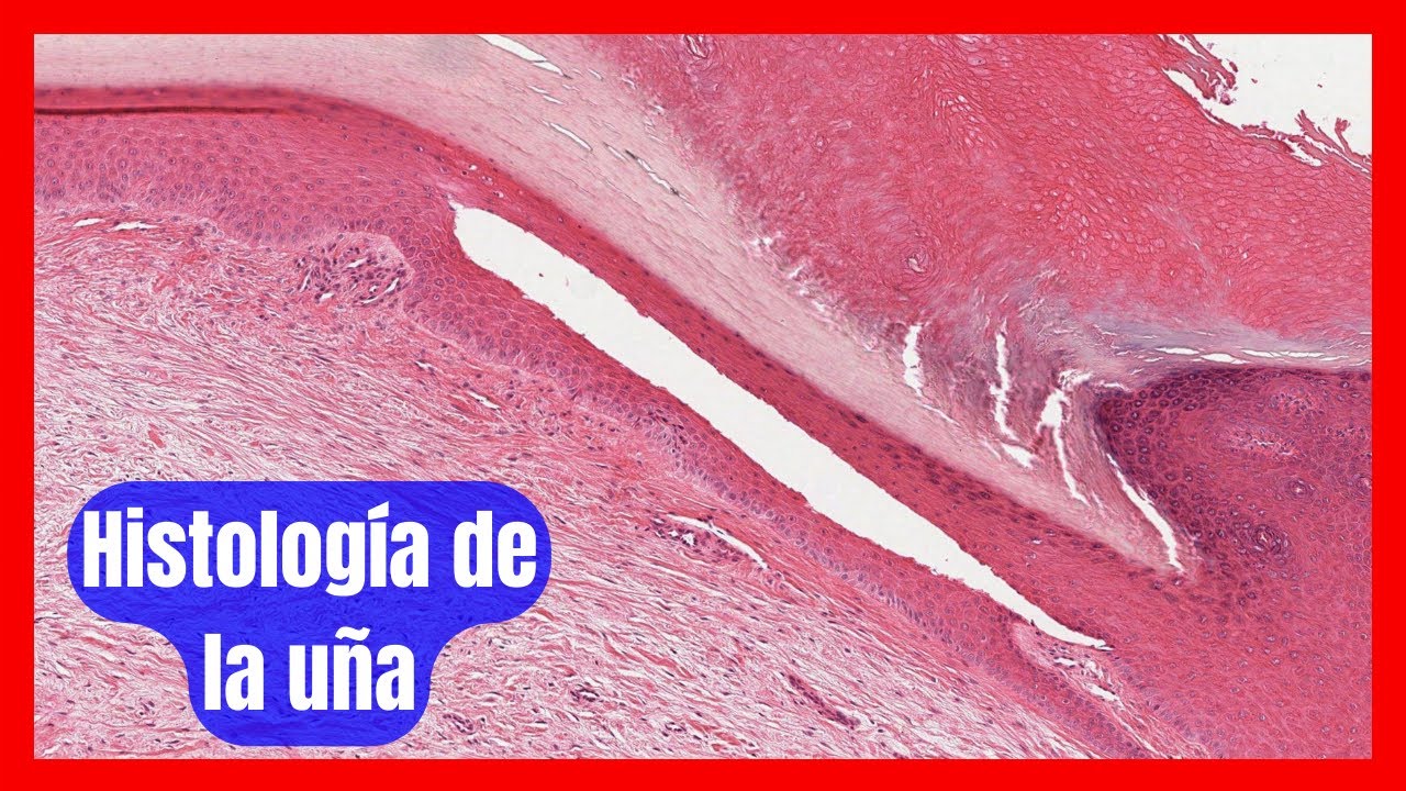 Dermatopatología: histología de la uña - YouTube