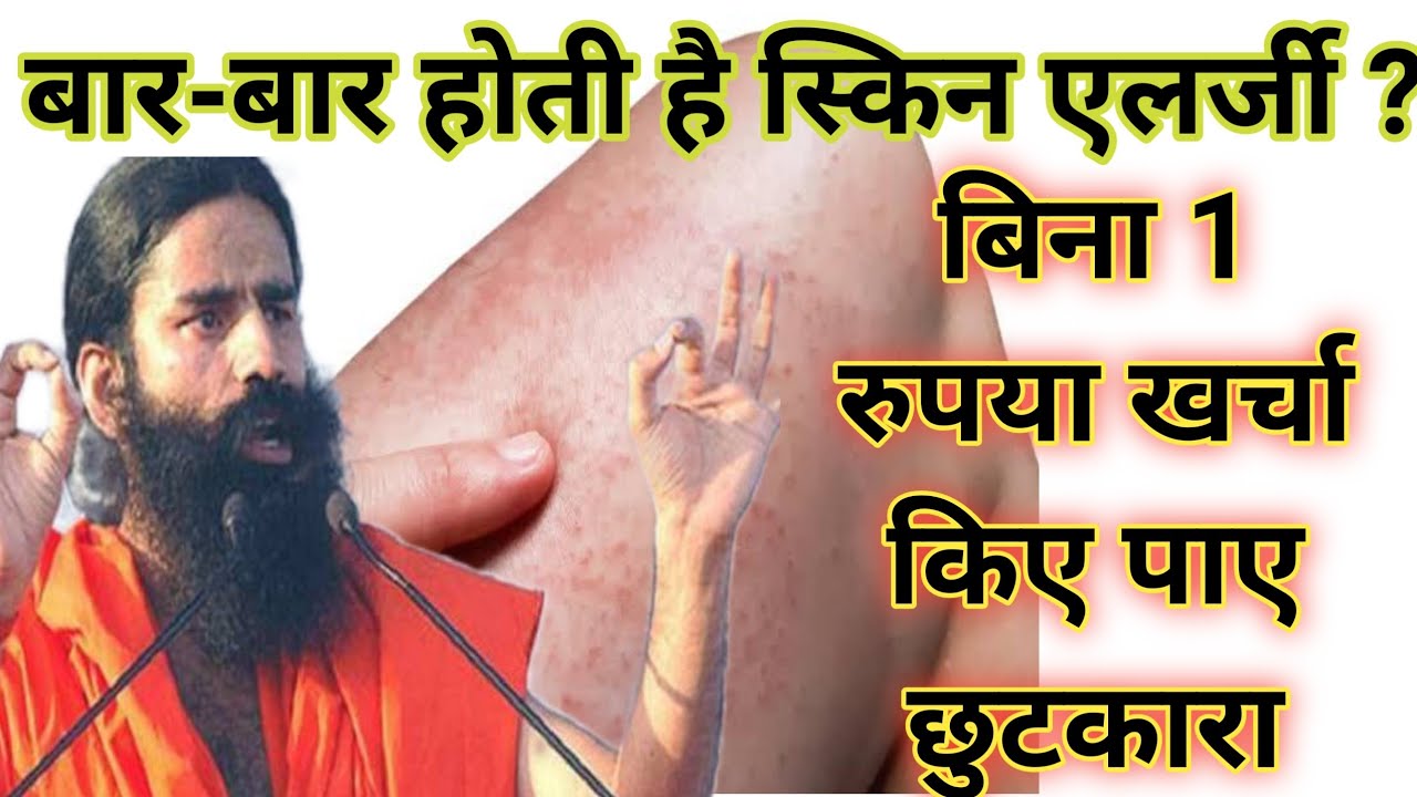 स्किन एलर्जी | skin elarji ka ilaj | skin allergy treatment at home ...