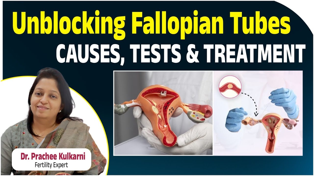 Unblocking Fallopian Tubes: Causes, Tests, and Treatment Options ...