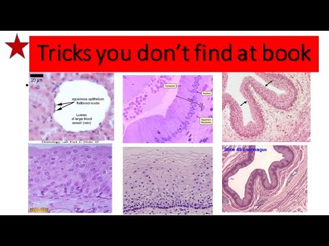 Histology slide identification tricks I Epithelium I Easy tips for ...