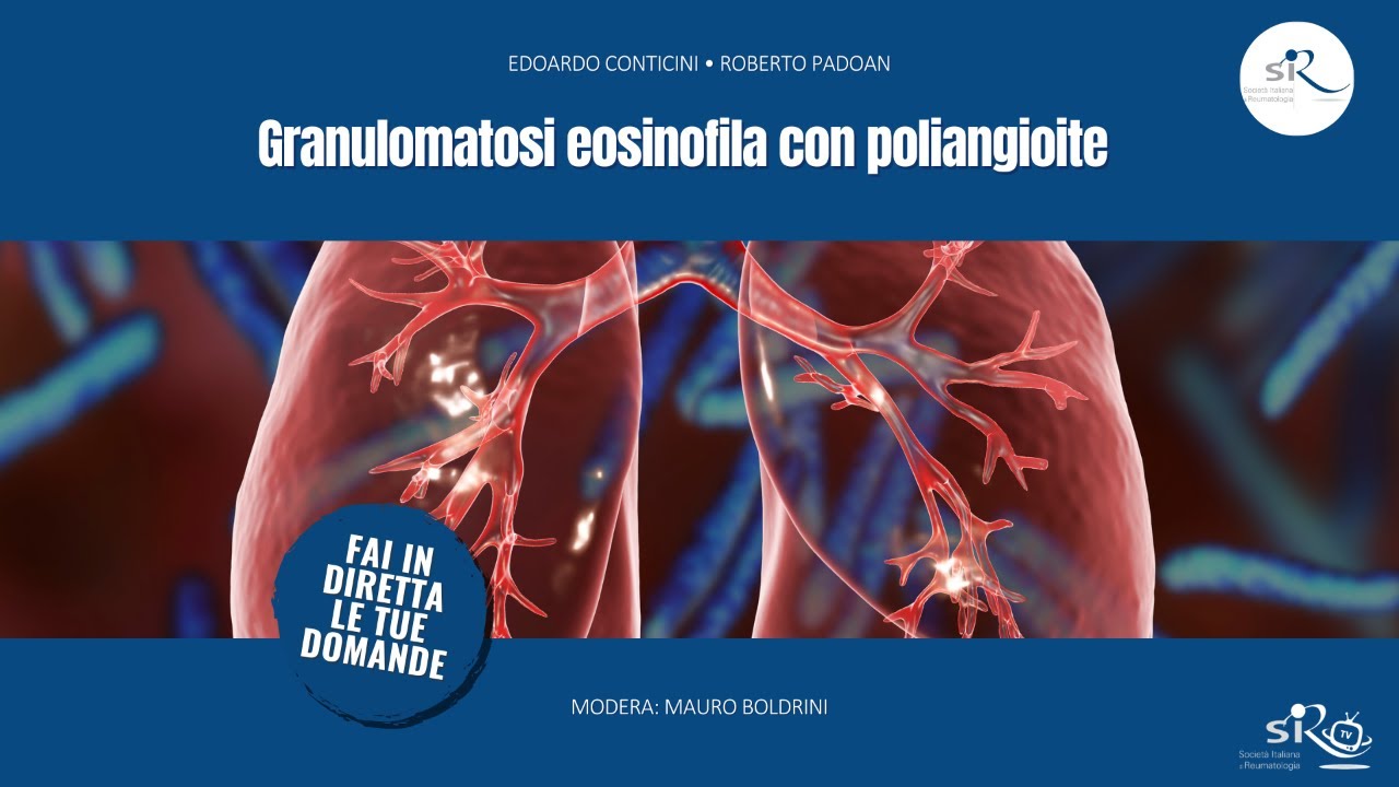 Granulomatosi eosinofila con poliangioite - YouTube
