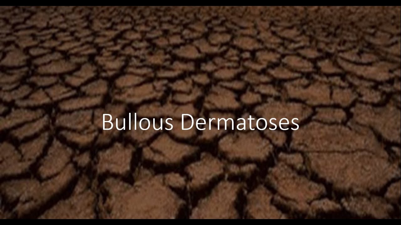 Bullous Dermatoses By Dr. Bahaa Aldin Alkatry - YouTube