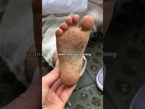 Don’t Let Your Kids Go BAREFOOT! ❌