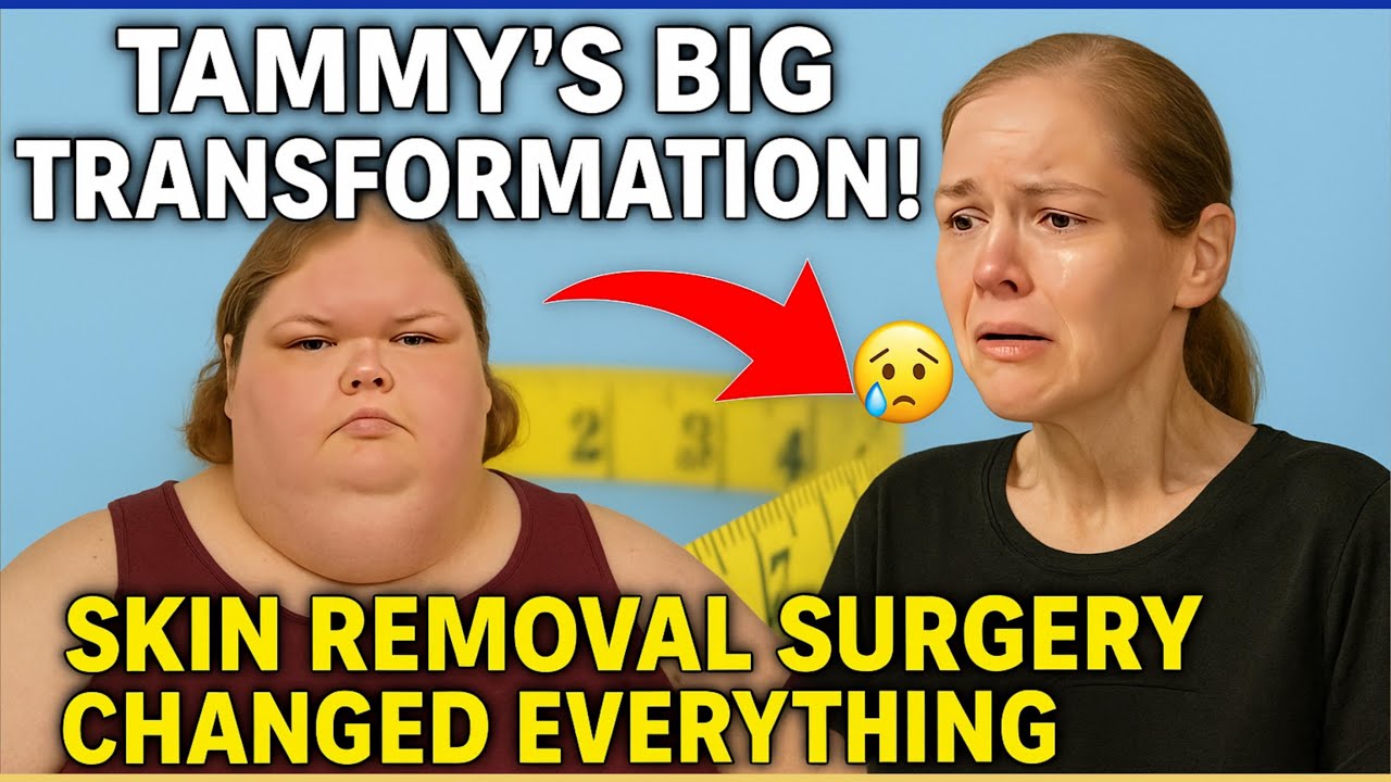 “Tammy Slaton Breaks Down After Skin Removal Surgery – You Won’t ...