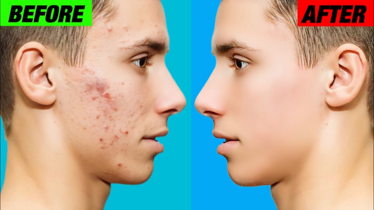 How to make face clear and glowing | look naturally beautiful | Improve ...