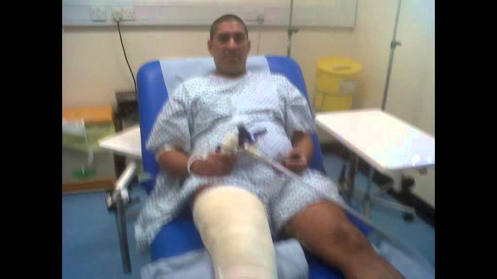 Broken Leg - YouTube