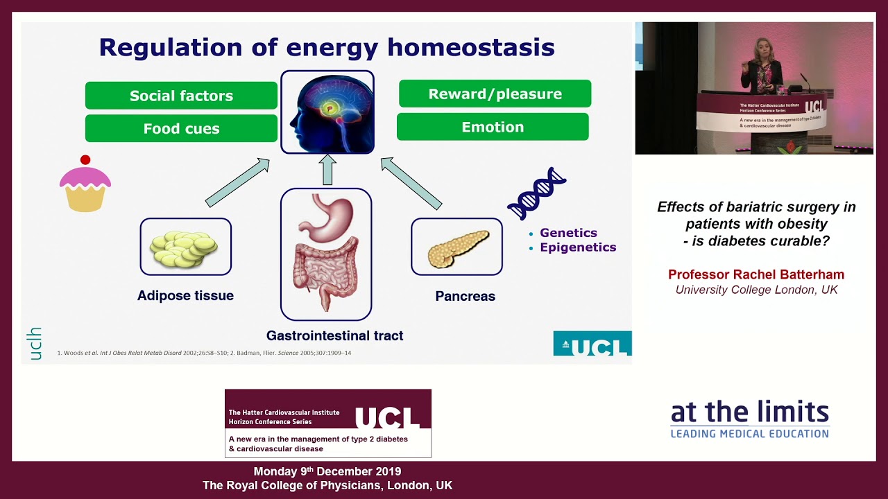 Prof.Rachel Batterham - Effects of bariatric surgery in patients w ...