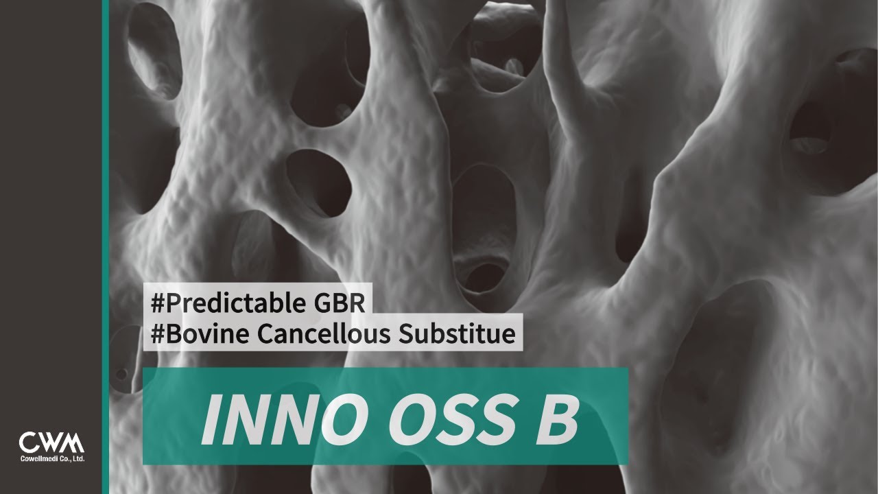 InnoOss B Intro - YouTube