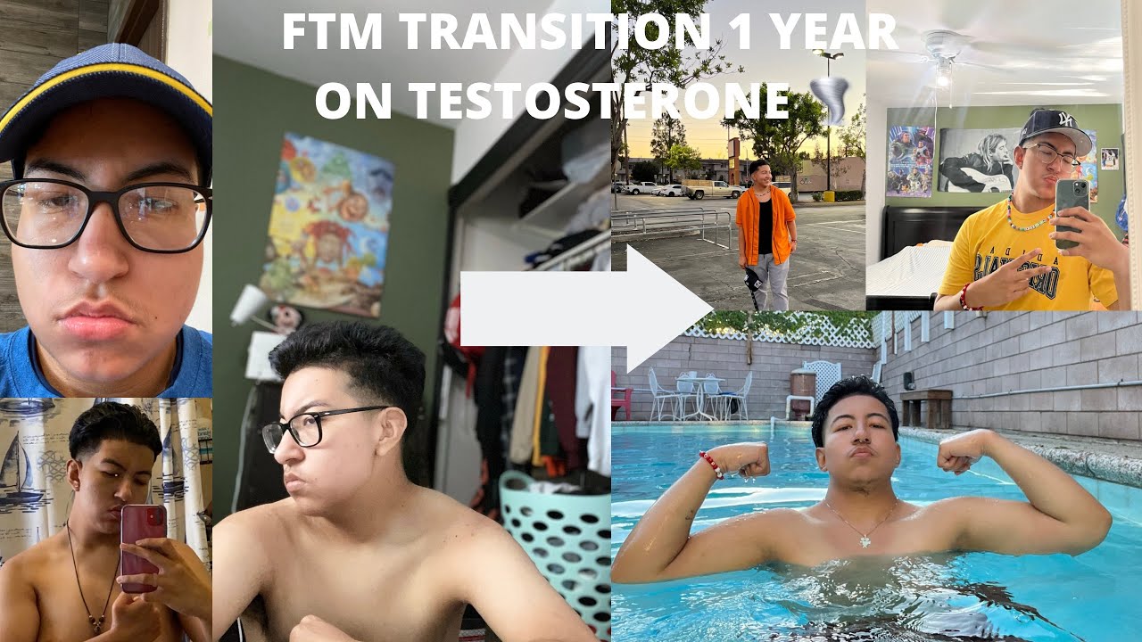 FTM TRANSITION 1 YEAR ON T 🌪 - YouTube
