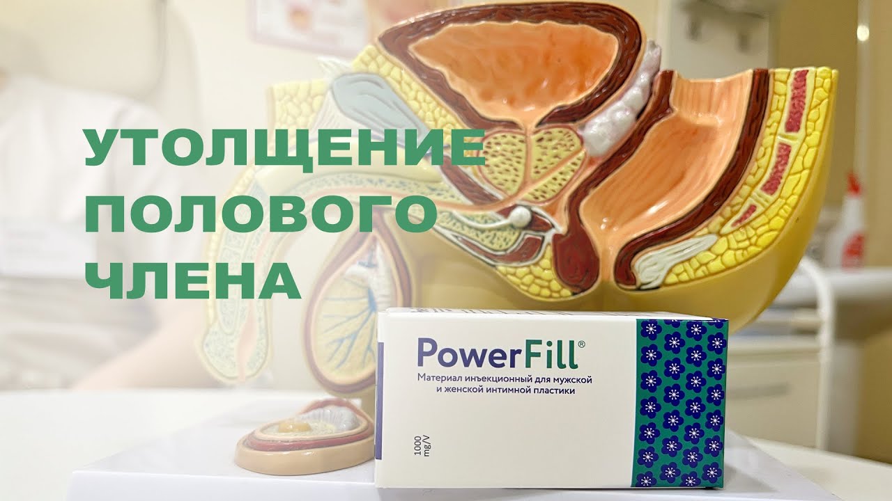 Утолщение полового члена Безопасный и современный метод Youtube