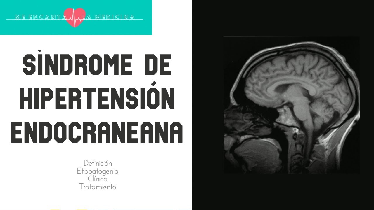 Síndrome de hipertensión endocraneana - YouTube