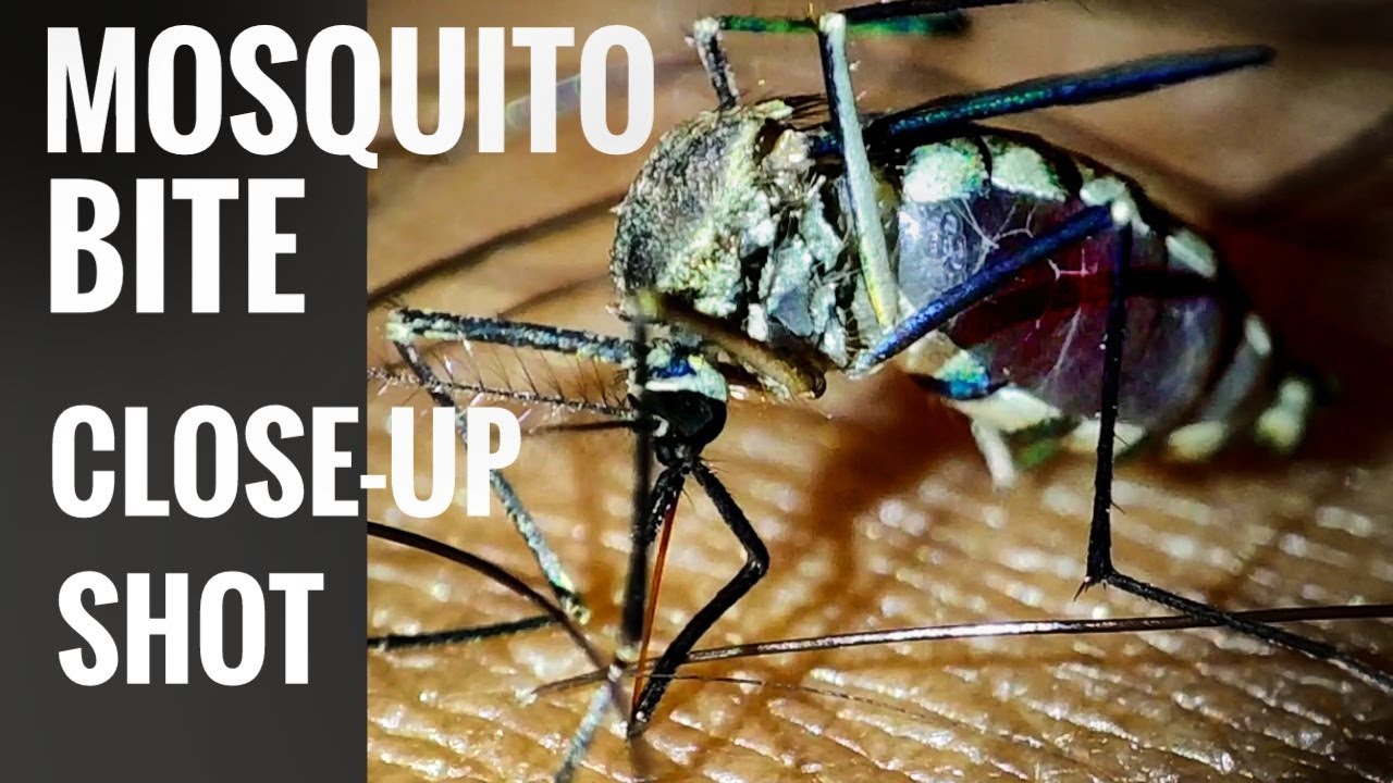 Mosquito bite, close-up shot | shot on macro camera - YouTube