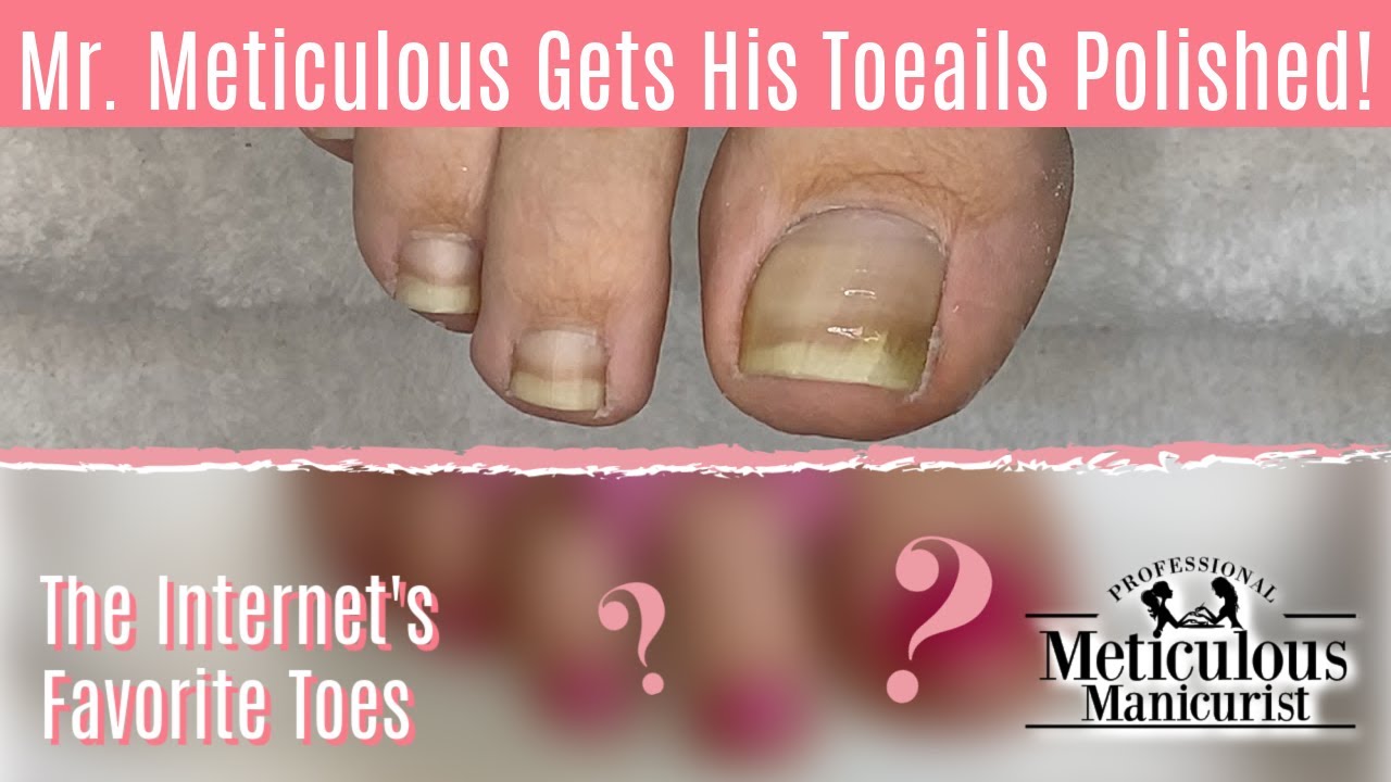 Ingrown Toenail & Impacted Toenail Pedicure: Relief, Causes and ...