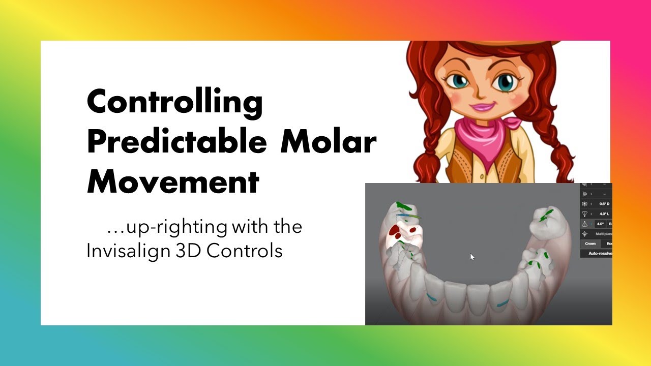 Invisalign ClinCheck - Uprighting molars with 3D controls - YouTube