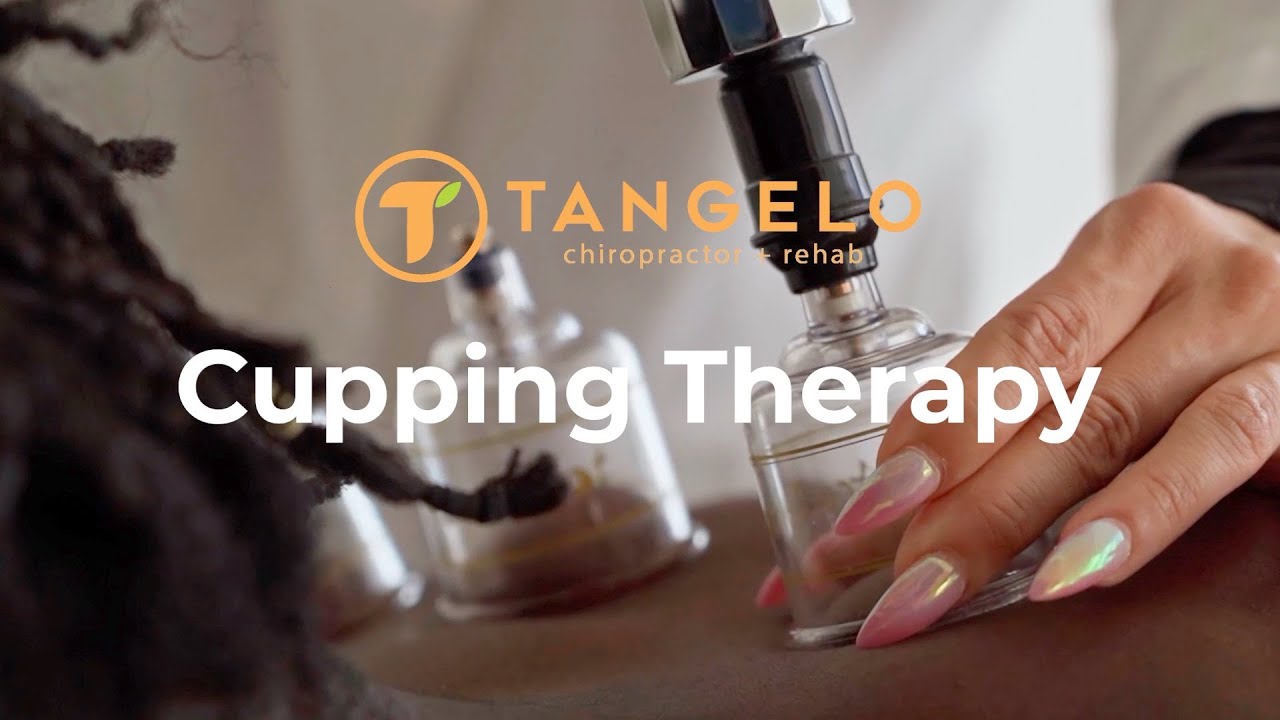 How Cupping Can Help With Injury Recovery - YouTube