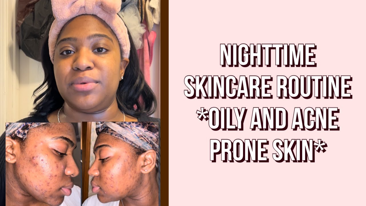 Updated Nighttime Skincare Routine | How I Cleared My Oily and Acne ...