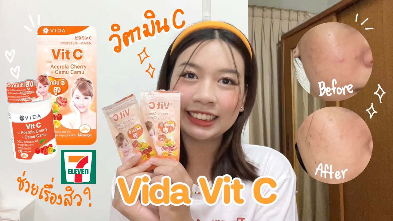 รีวิว Vida Vit C ช่วยเรื่องสิว? ทาน 10 วัน เห็นผลจริงไหม?🧡🍊 - YouTube