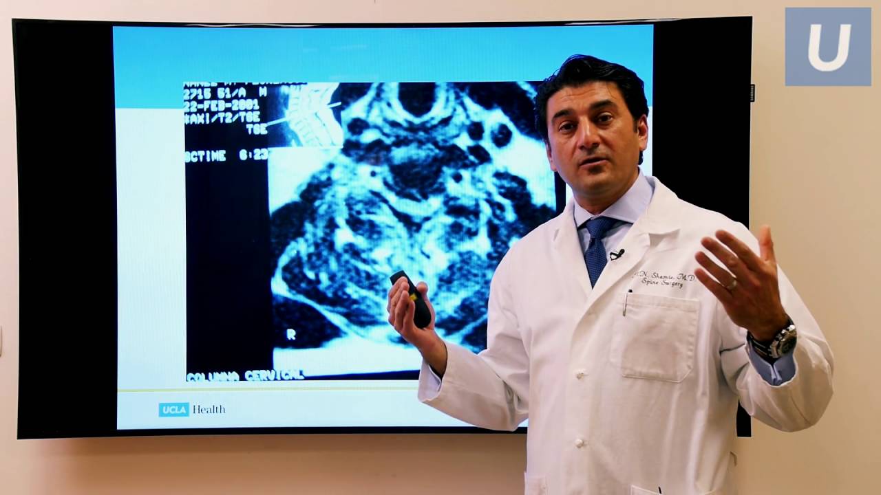 Novel Treatments in Spinal Surgery | Nick Shamie, MD | UCLAMDChat - YouTube