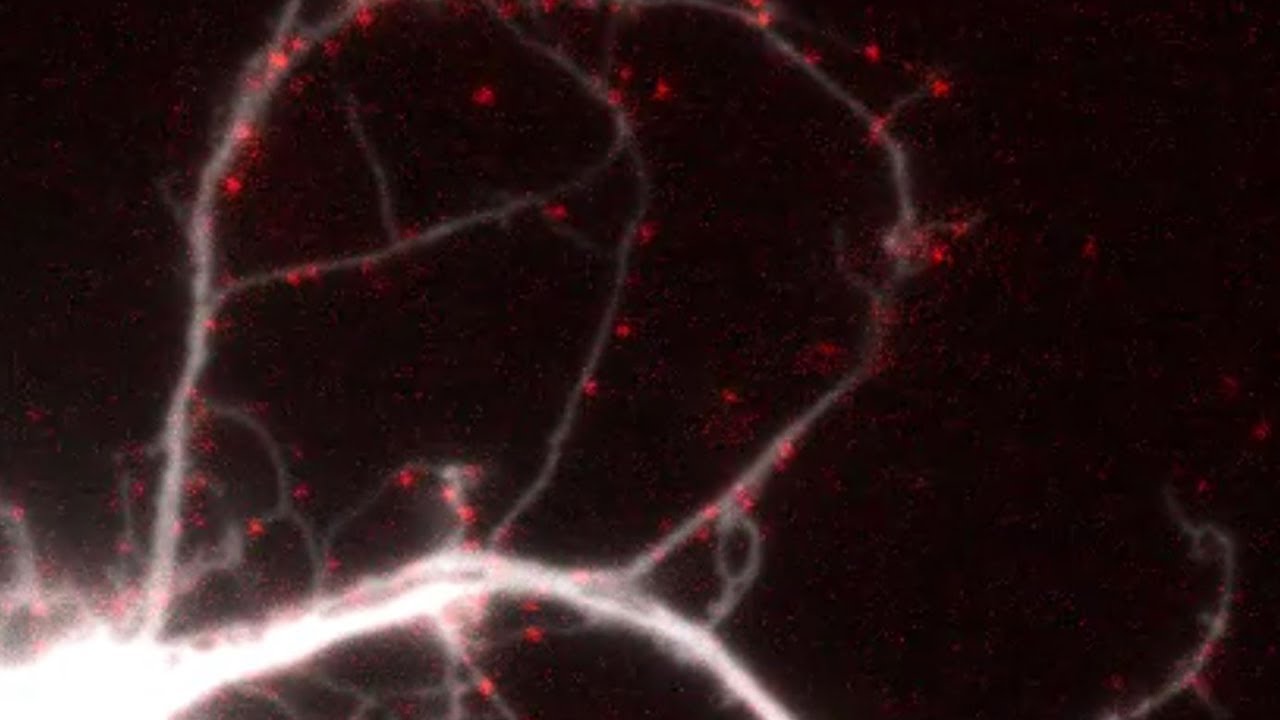 Single molecule imaging of SARS-CoV-2 spike protein (red) on a live ...