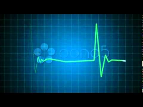 Stock Video Footage  EKG heart monitor goes flatline HD PAL   18 01 2011, 19 54