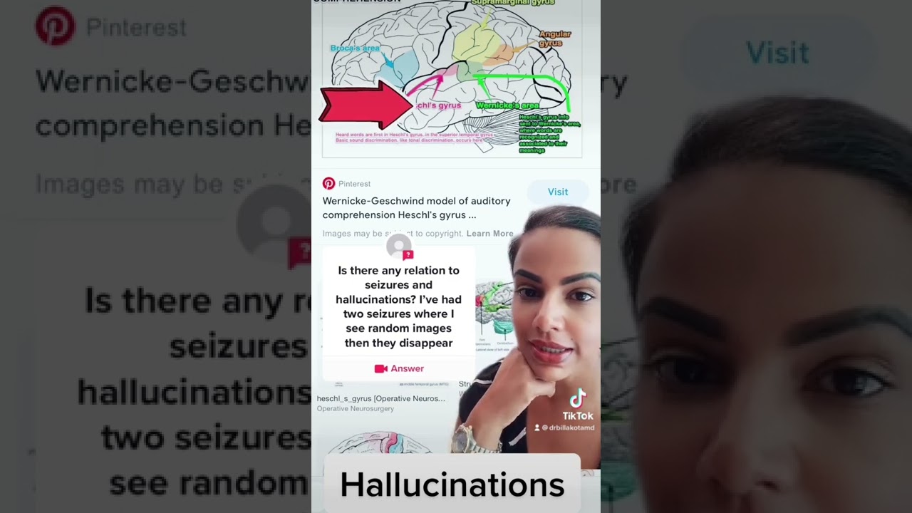 Hallucinations with Epilepsy - YouTube