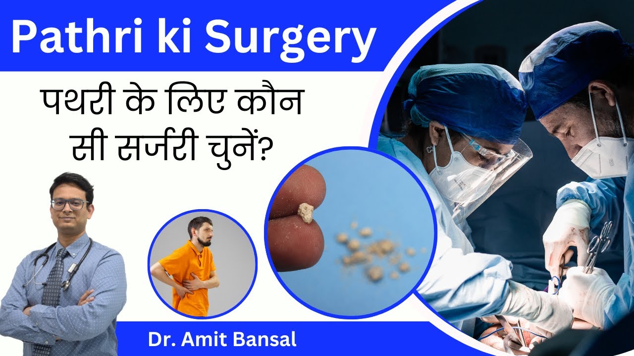 Pathri Ka सही इलाज: Laser, PCNL, Ya RIRS? I | Kaun Si Surgery Aapke ...