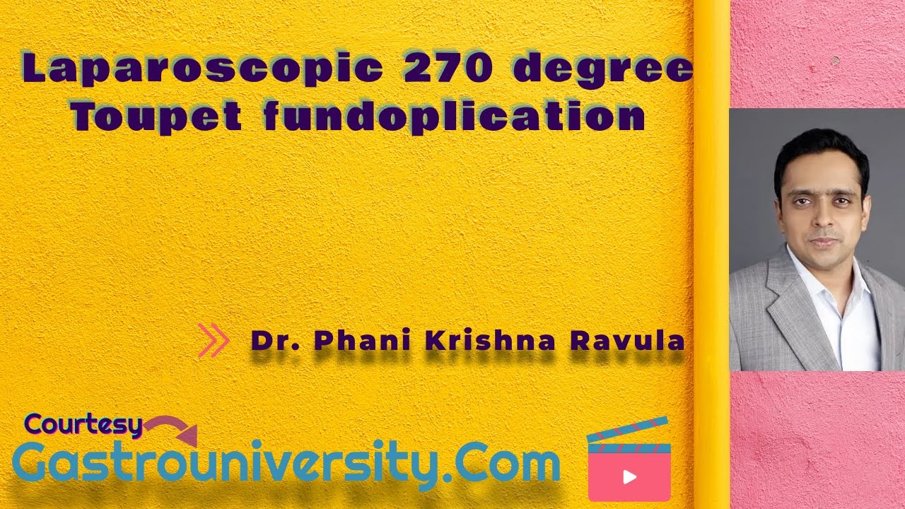 Stomach-Laparoscopic 270 degree Toupet fundoplication - YouTube