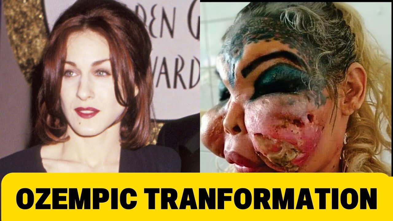 10 Celebrity Ozempic Transformations That Went Horribly Wrong in 2025 ...