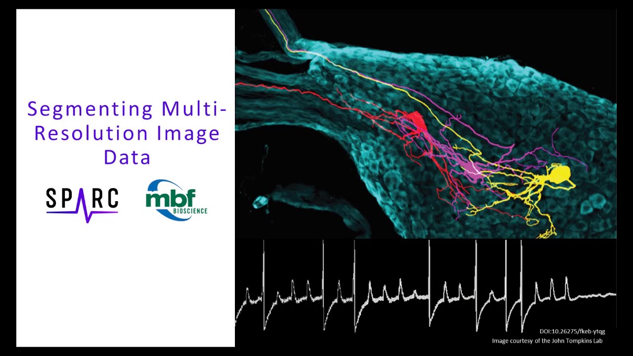 3D Neuron Reconstruction and 3D Cellular Mapping in Multi-Resolution ...
