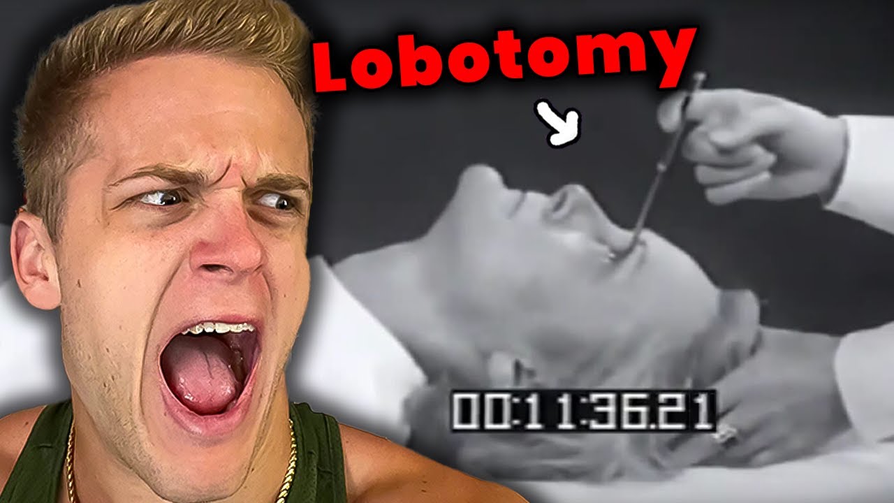 The DUMBEST Surgery In History. - YouTube