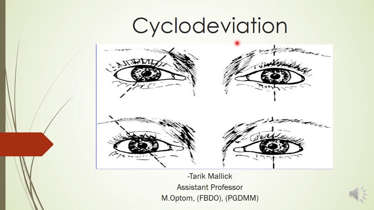 CYCLODEVIATIONS - INCYCLODEVIATION & EXCYCLODEVIATION - YouTube