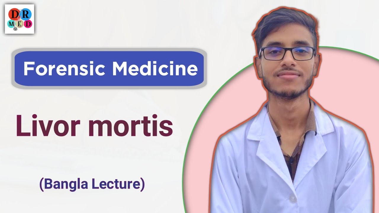 Postmortem hypostasis | Cadaveric lividity | Livor mortis | Forensic ...