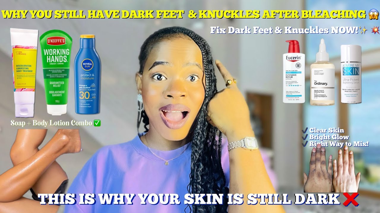 Why You Still Have DARK FEET & KNUCKLES After BLEACHING + The Best Way ...
