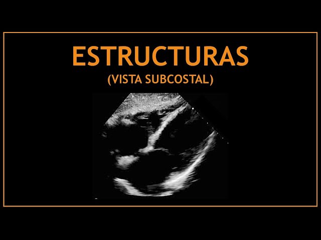 Imagen De La Ecografía Del Corazón Fetal Vista Subcostal