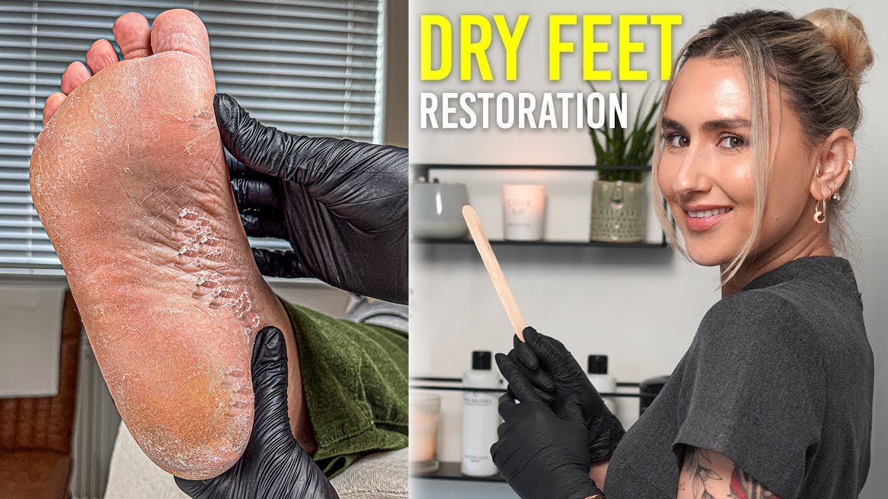 Restoring Dry Cracked Feet And Heels (SATISFYING) - YouTube