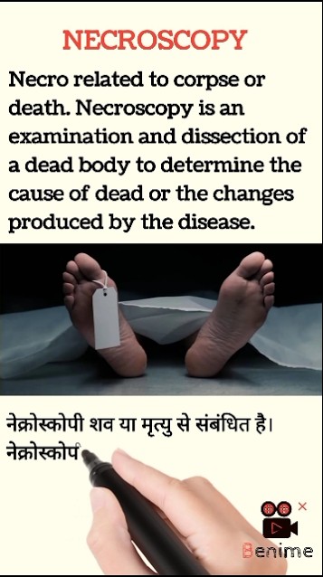 What is NECROSCOPY / Necroscopy kab karna parta he / #necroscopy # ...