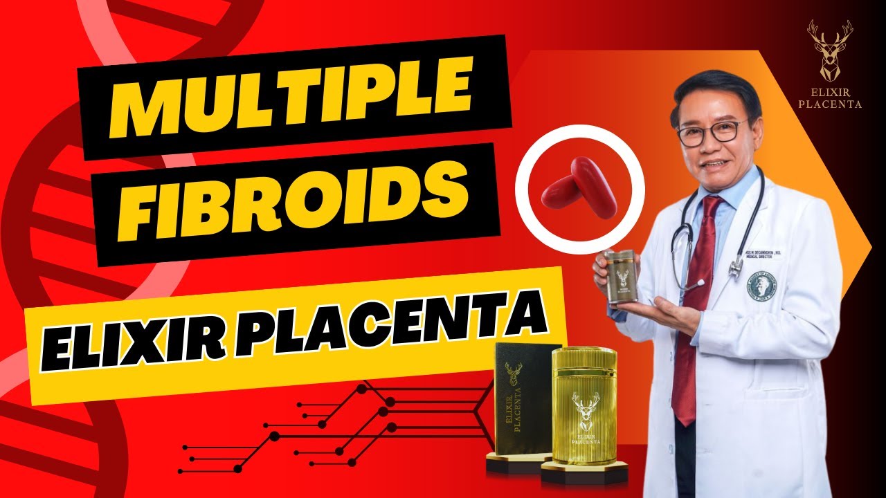 MULTIPLE FIBROIDS | ELIXIR PLACENTA - YouTube