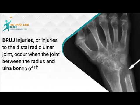 Dr. Parth Agarwal | What is DRUJ Injury| Upperlimb Surgeon in Thane - YouTube