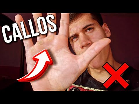 Como CURAR y CUIDAR los Callos de las MANOS | TÍPS Y CONSEJOS PARA ...