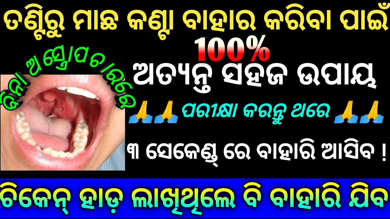 Fish bones Successful Removal from Throat | How to Remove Fish Nails ...