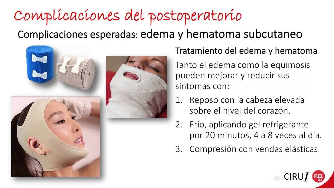 Postoperatorio General y Local. 2da Parte - YouTube