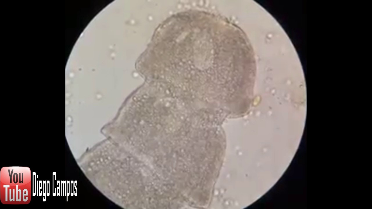 Taenia solium - Proglotido - YouTube
