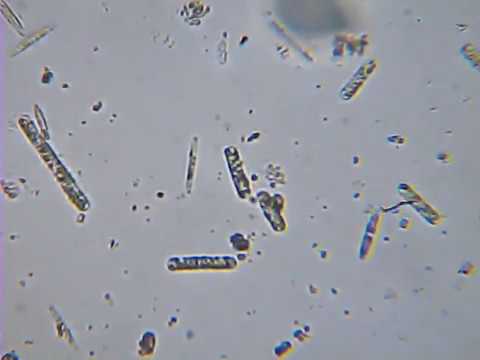 Alga Diatomea navicula 640x al microscopio. Agua de maceta. - YouTube
