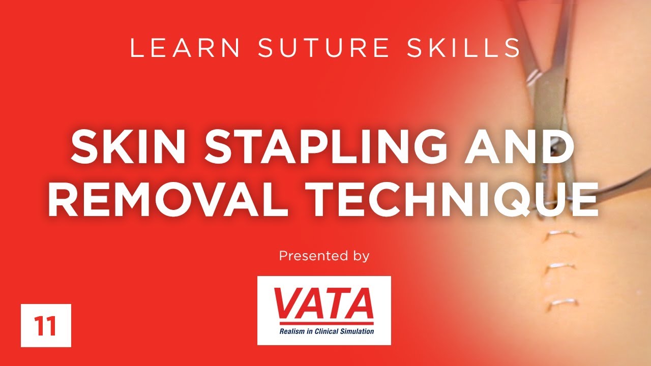 Skin Stapling and Removal Technique - Learn Suture Techniques - VATA ...